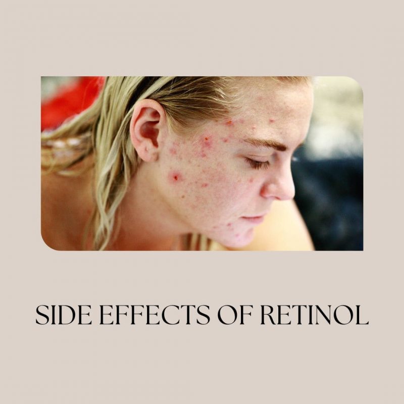 How Long Should You Use Retinol Cream For? | Lifestyle in Cloud